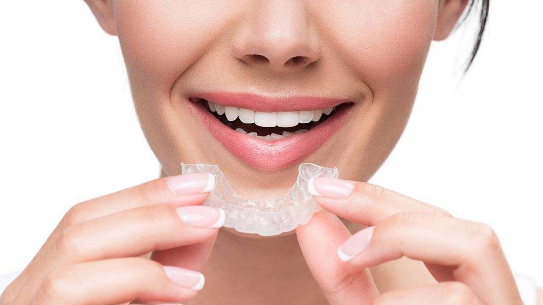 The Top 4 Benefits of Invisalign® | Invisalign® St. Augustine FL